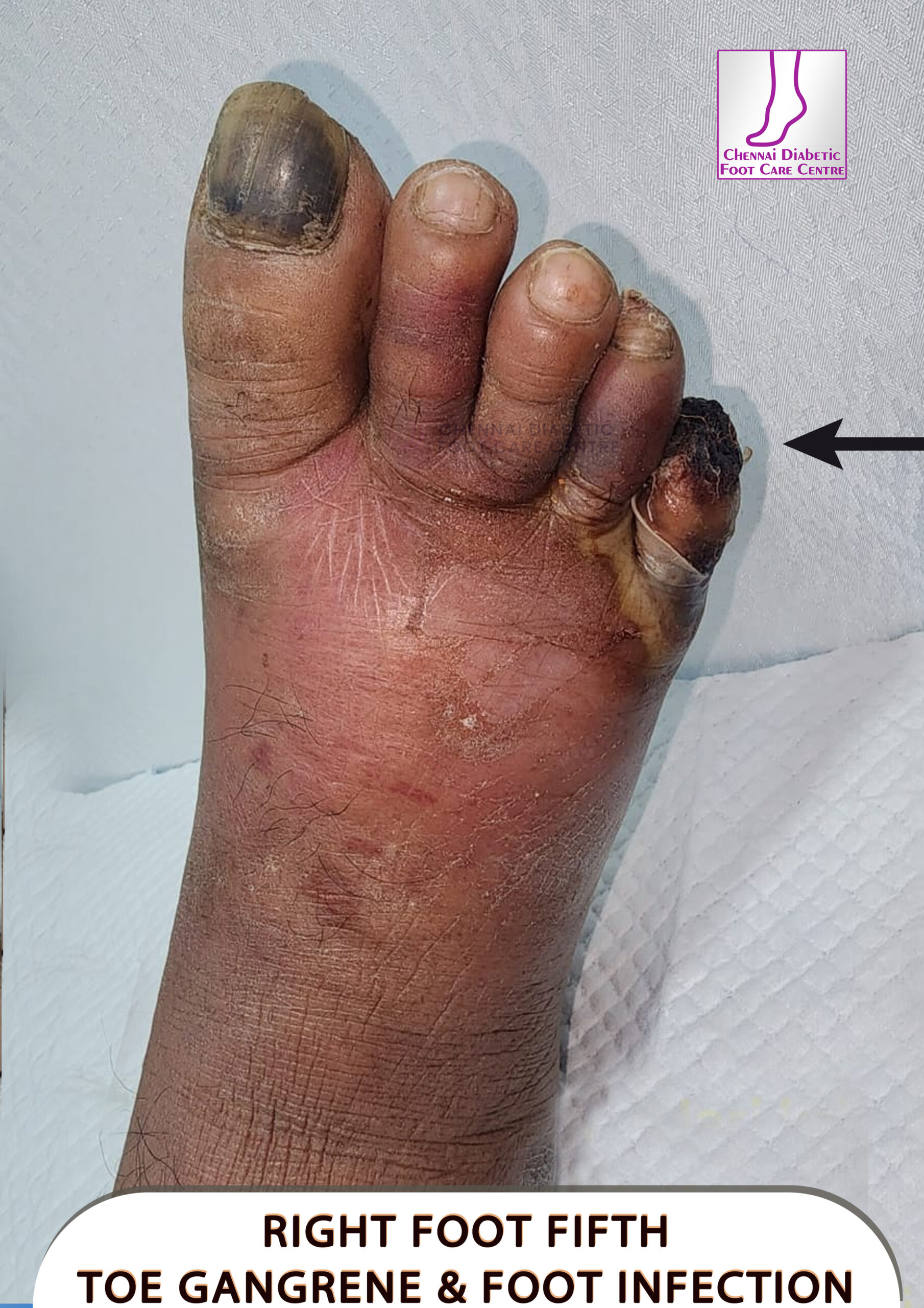 Clinical Cases – CDFC Hospital