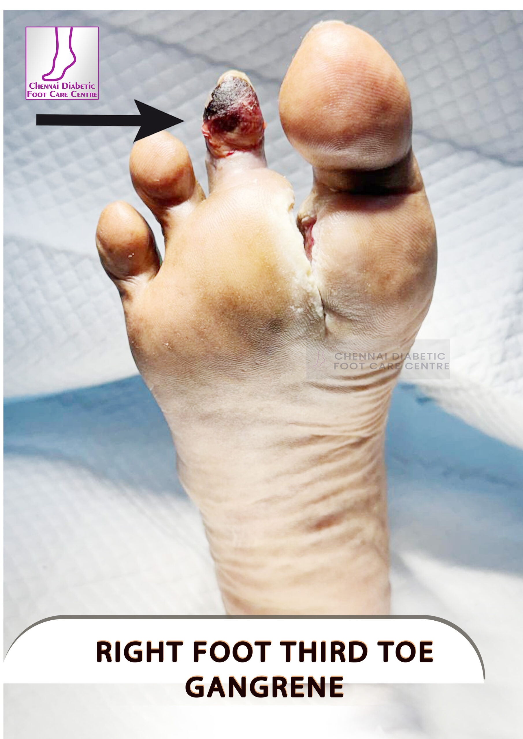 Clinical Cases – CDFC Hospital