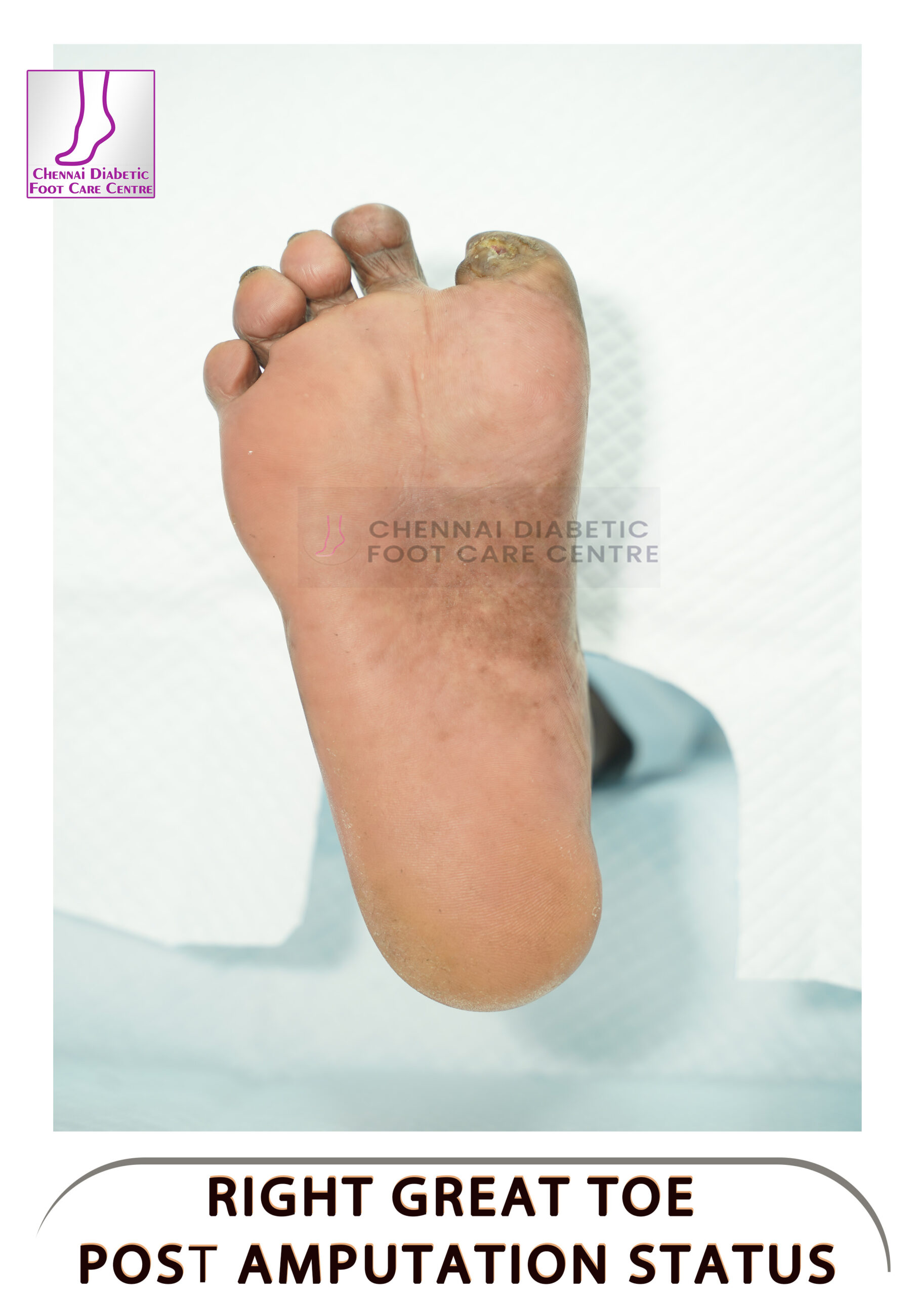 Clinical Cases – CDFC Hospital