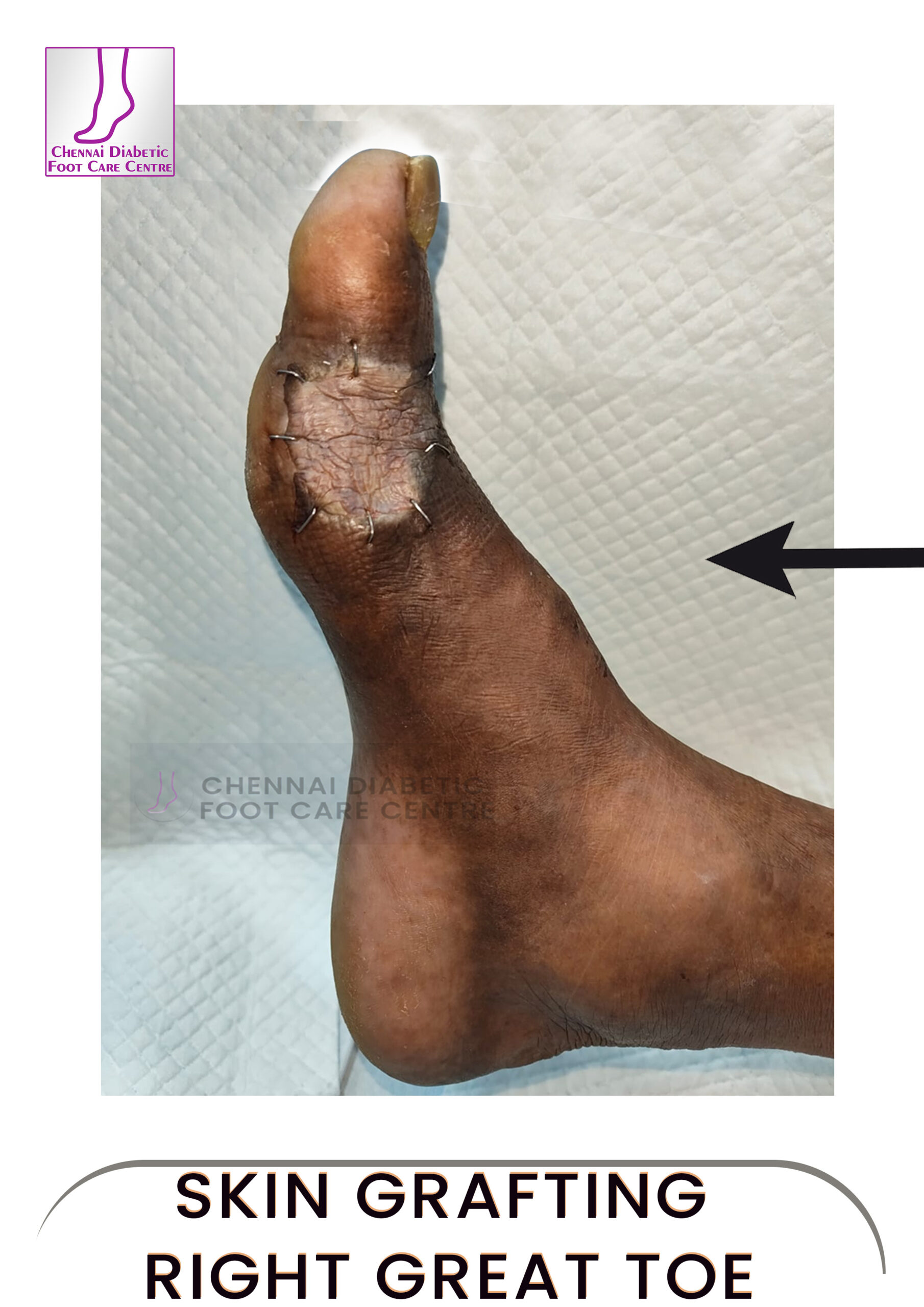 Clinical Cases – CDFC Hospital