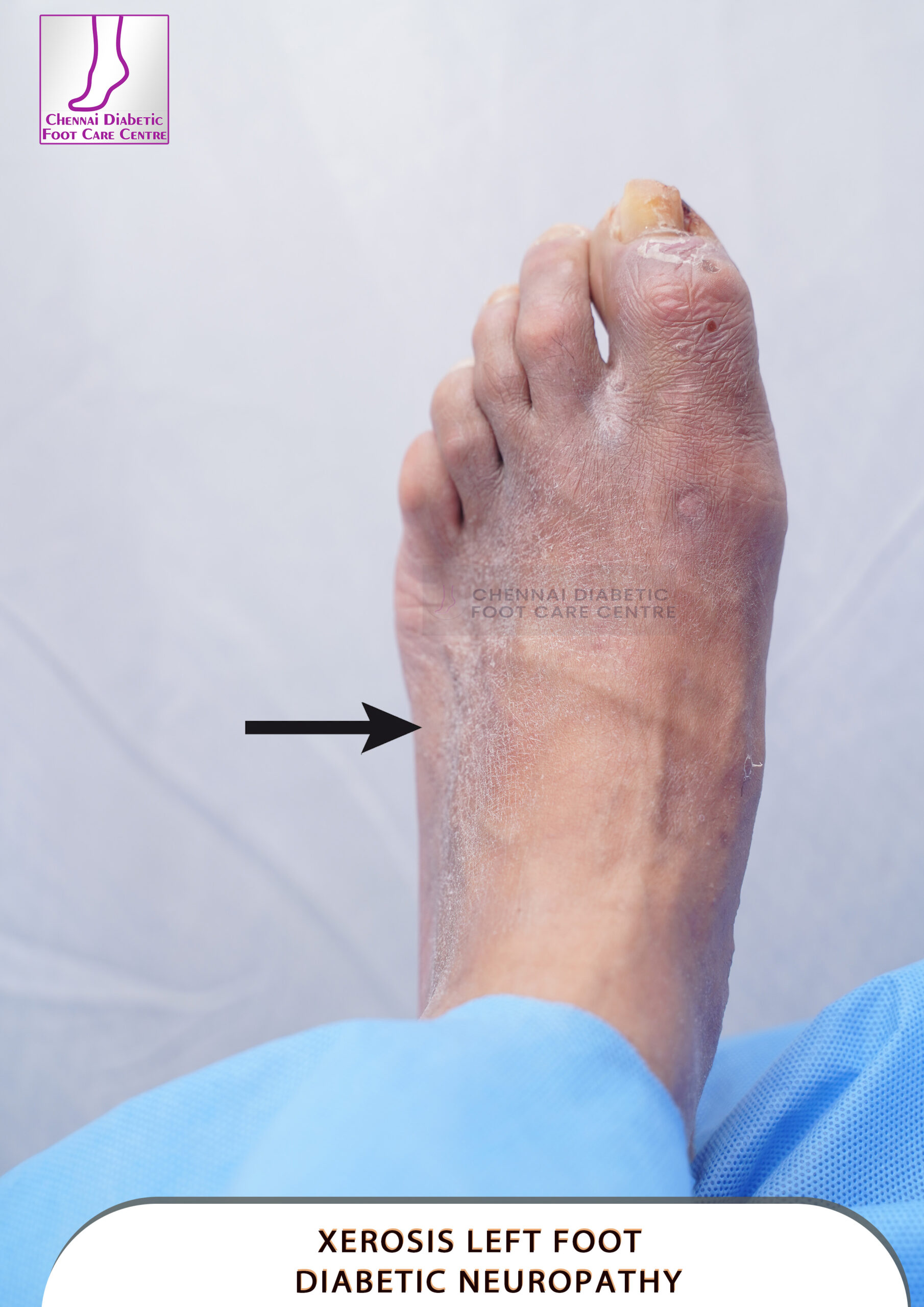 Clinical Cases – CDFC Hospital