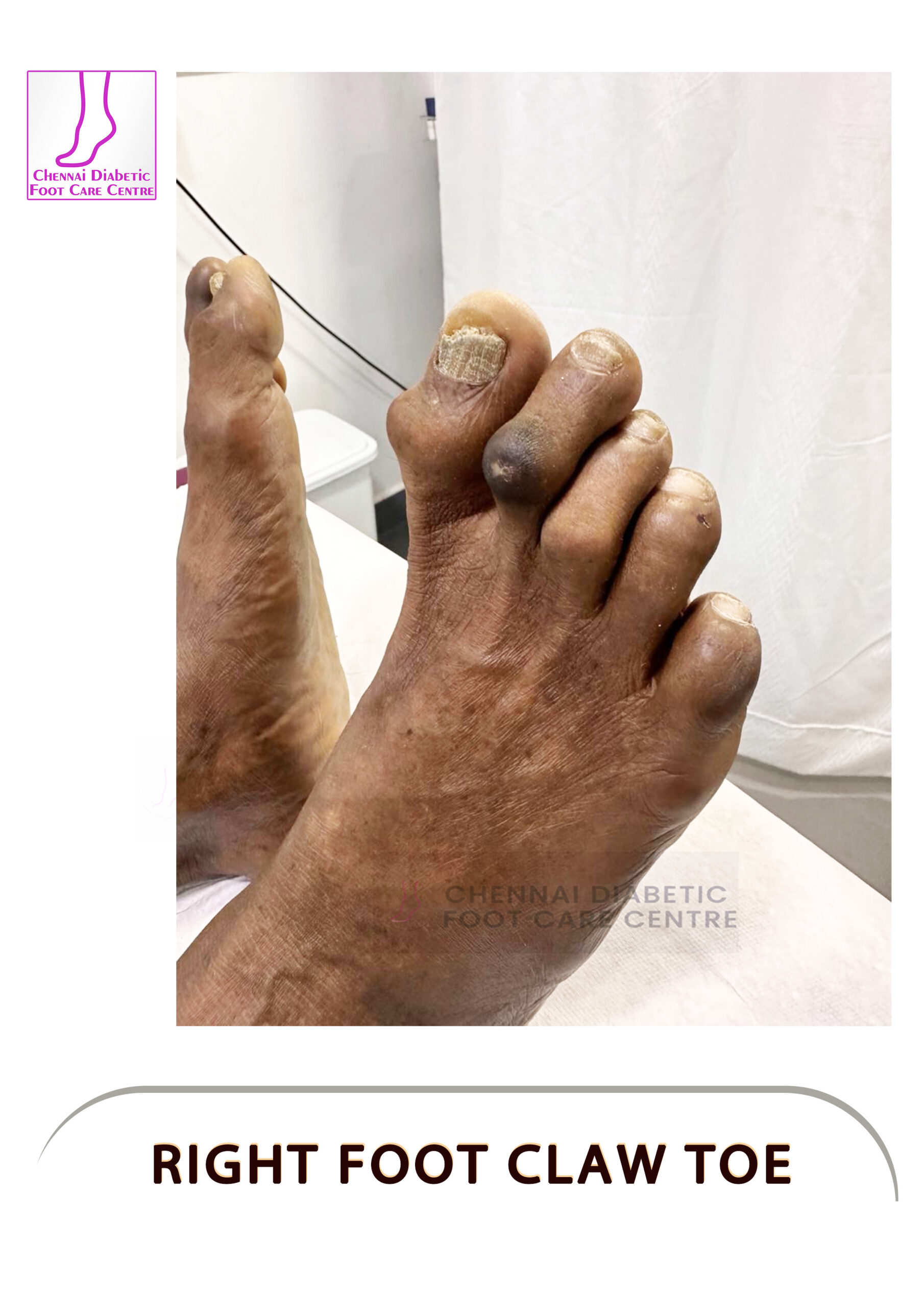 Clinical Cases – CDFC Hospital