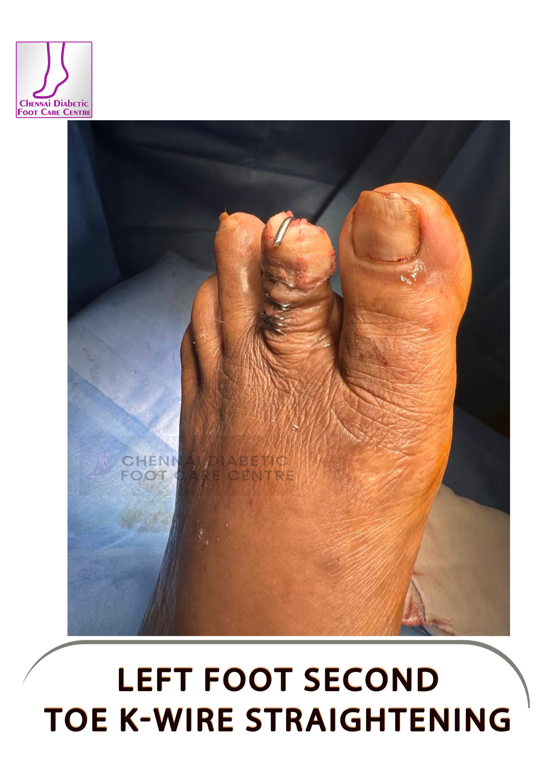Clinical Cases – CDFC Hospital
